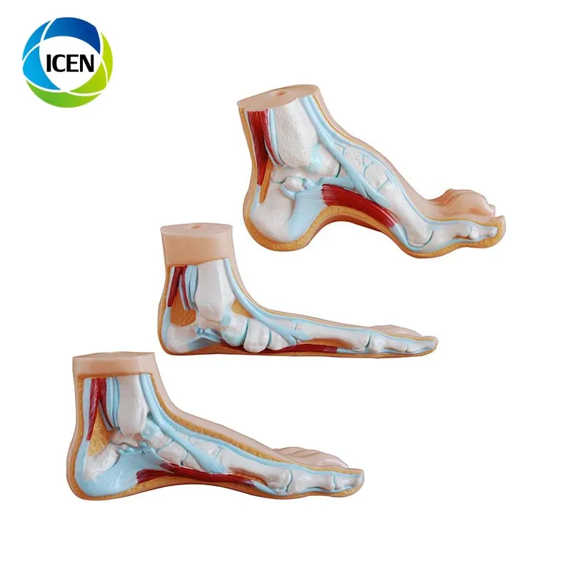 IN-311 PVC Flat Foot Model - Anatomical Teaching Tool