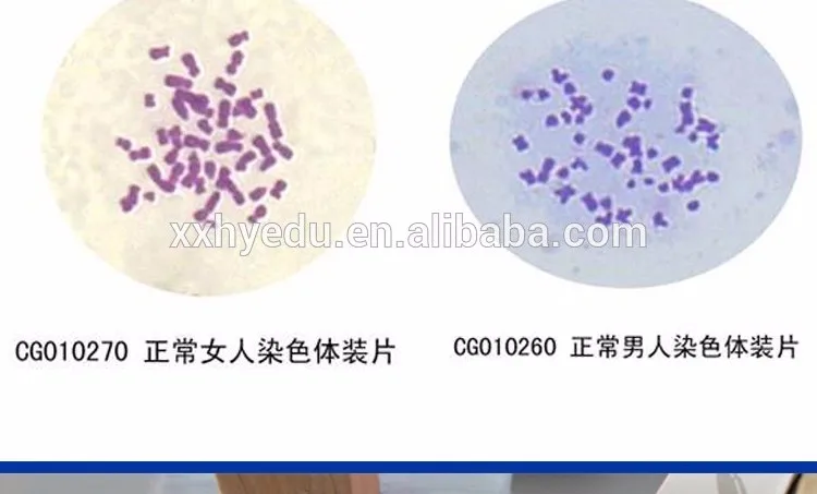 Fixed Set High Quality 14 Pieces Chromosome Microscope Prepared Slides ...