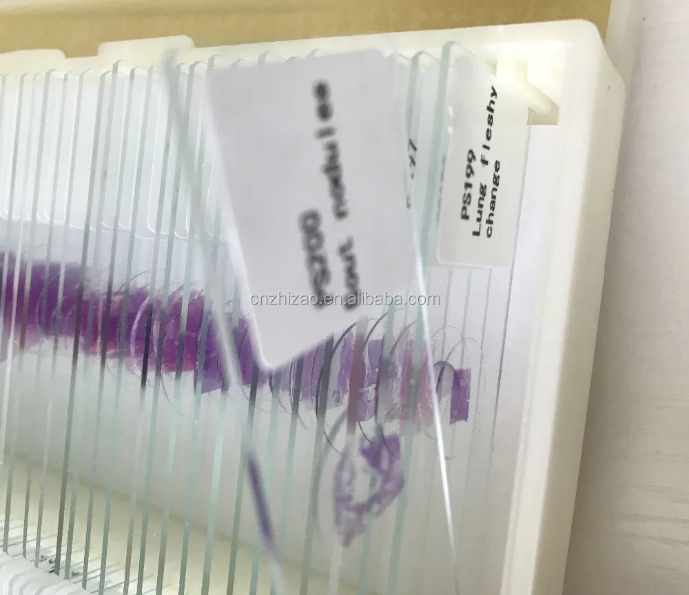 Professional 200 Pieces Set Microscope Human Pathology Prepared Slides ...