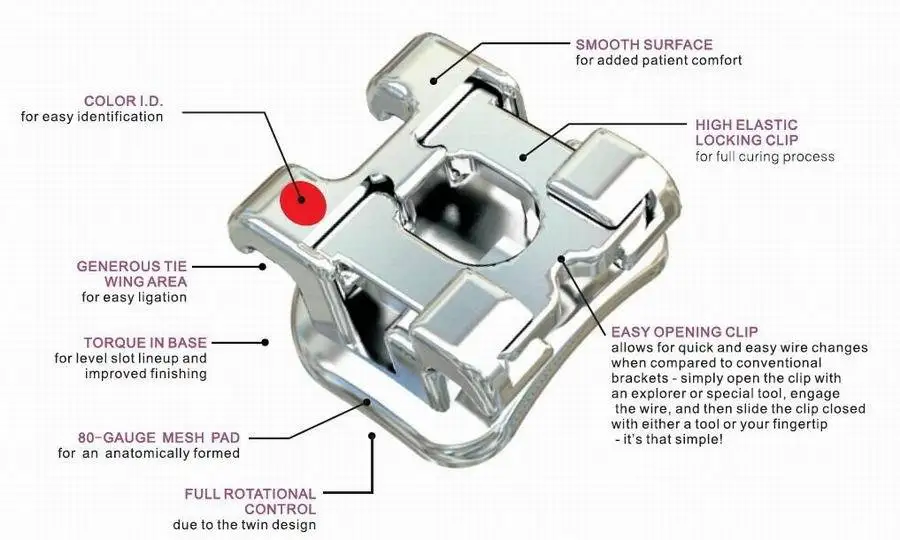 Parts Of Orthodontic Bracket at James Farris blog