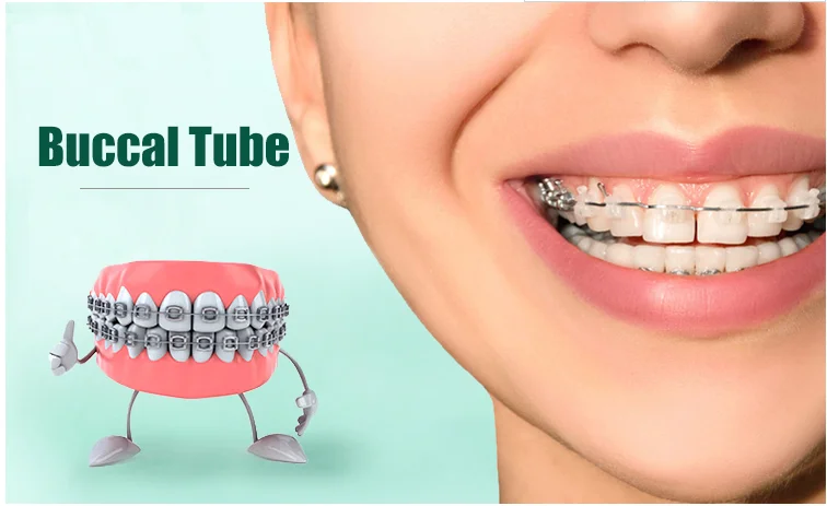 New Bondable Buccal Tube( Single,Double,Triple) - Buy High Quality ...