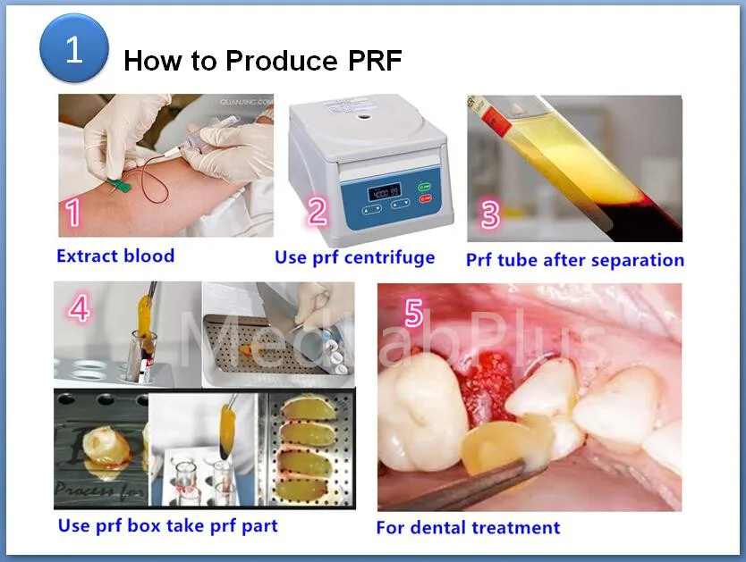 2023 Platelet Rich Fibrin Prf Box Dental Prf Tube Prf Centrifuge ...