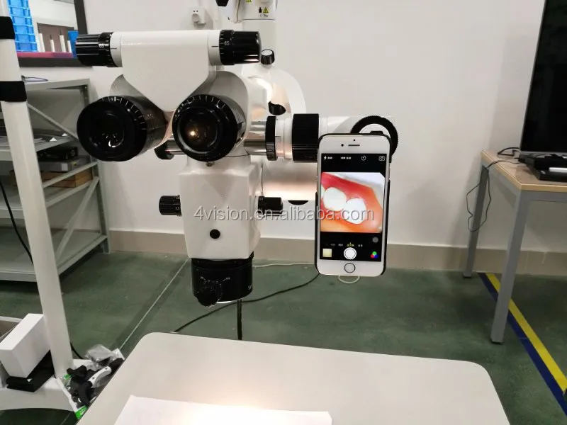 Digital Solution For Surgical Microscope And Slit Lamp Smartphone Video ...
