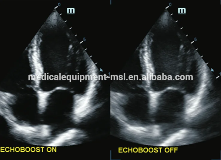 Mindray DC60 - Advanced 4D Color Doppler Ultrasound