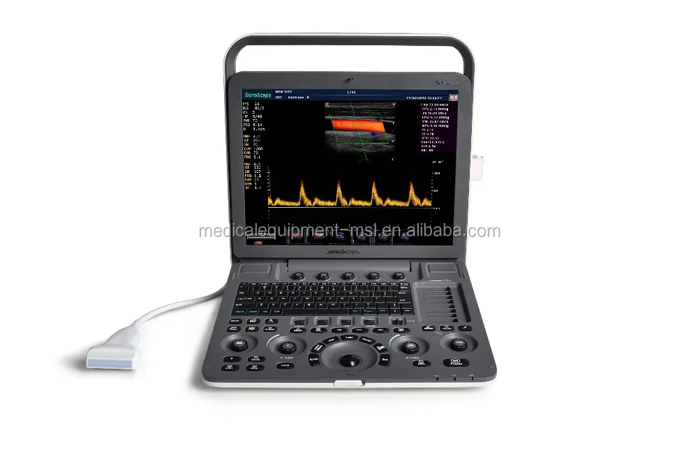 Sonoscape S8exp Ultrasound,Sonoscape S8exp Best Price,Ultrasound ...