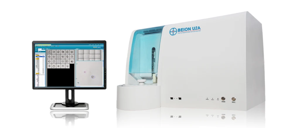 Beion Fully Automated Urine Sediment Analyzer - Buy Automated Urine Sediment Analyzer,Full ...
