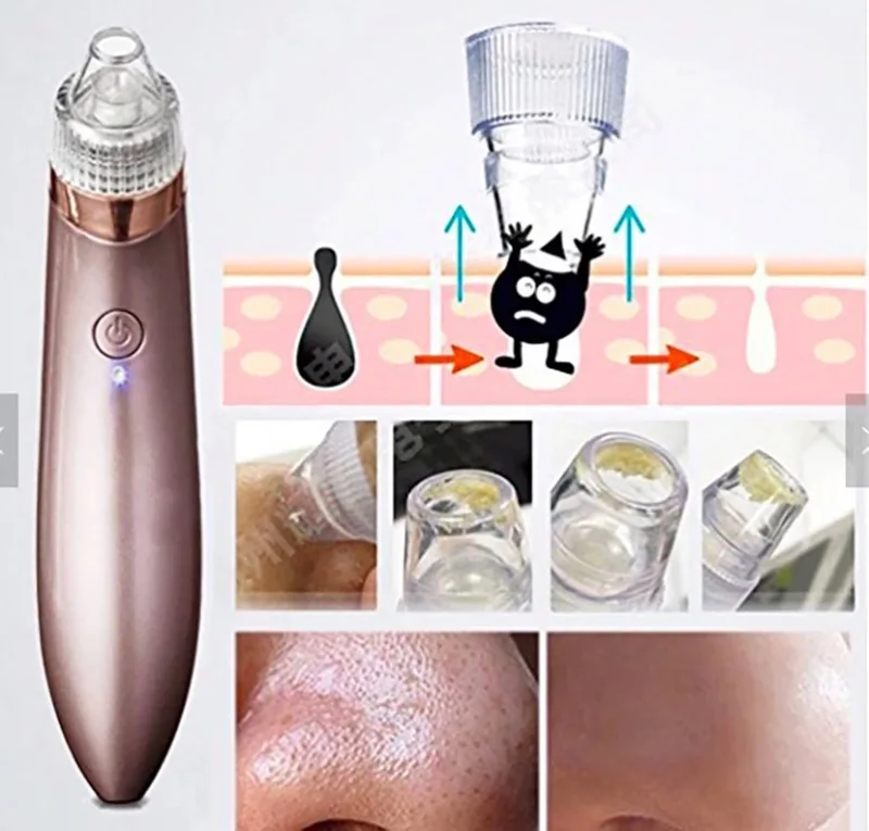 Electric Nose Pore Suction Skin Care Spot Cleaner Tool Kit Set Facial ...