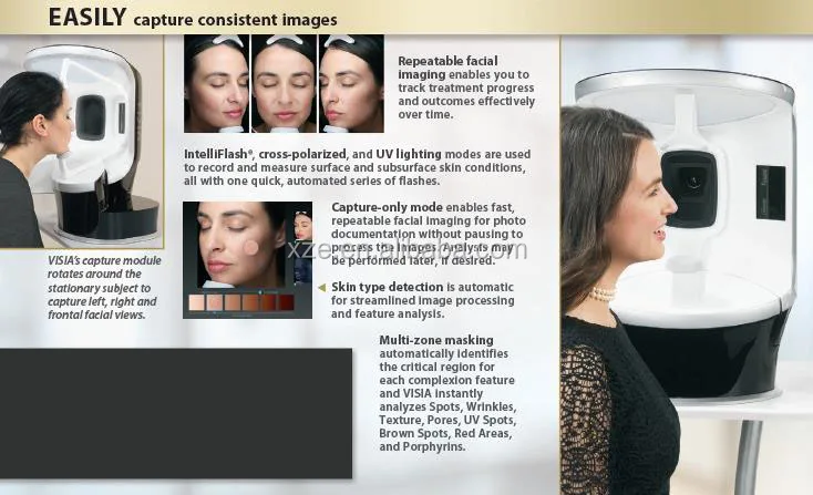 Dermatology 3d Visia Skin Analyzer Visia Skin Analysis Camera Machine ...