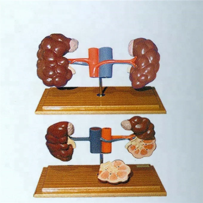 Cow Kidney Anatomy Model - Medical Science Educational Tool