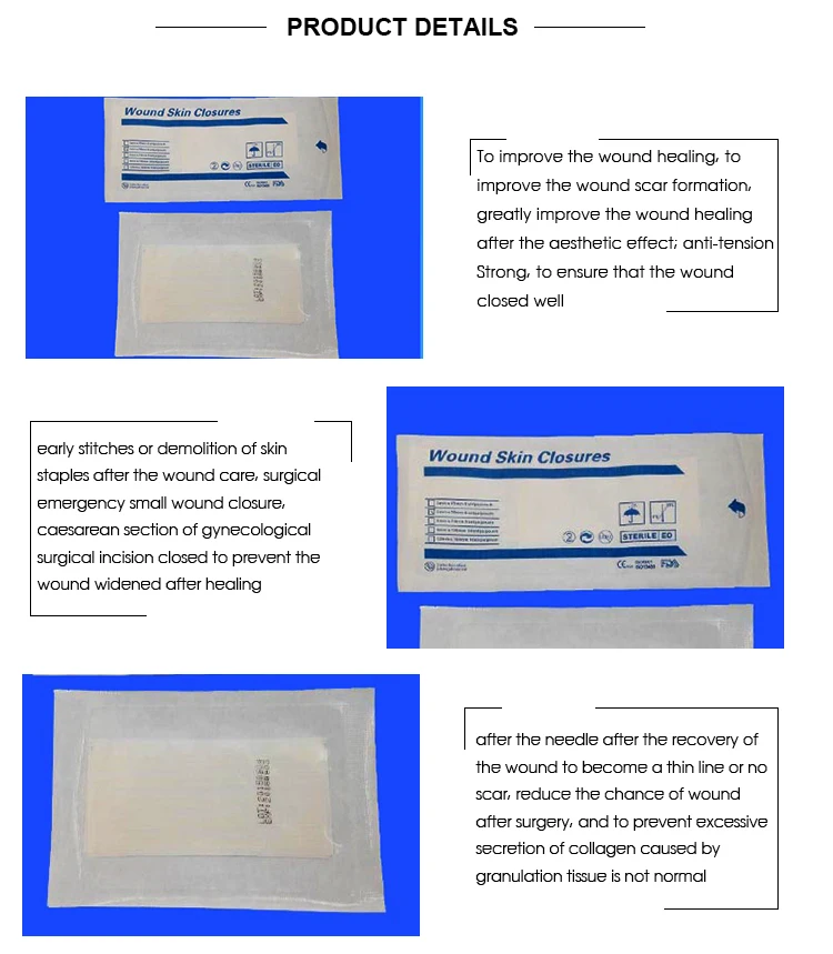 Disposable Adhesive Surgical Sterile Wound Dressing Skin Closure Strip ...
