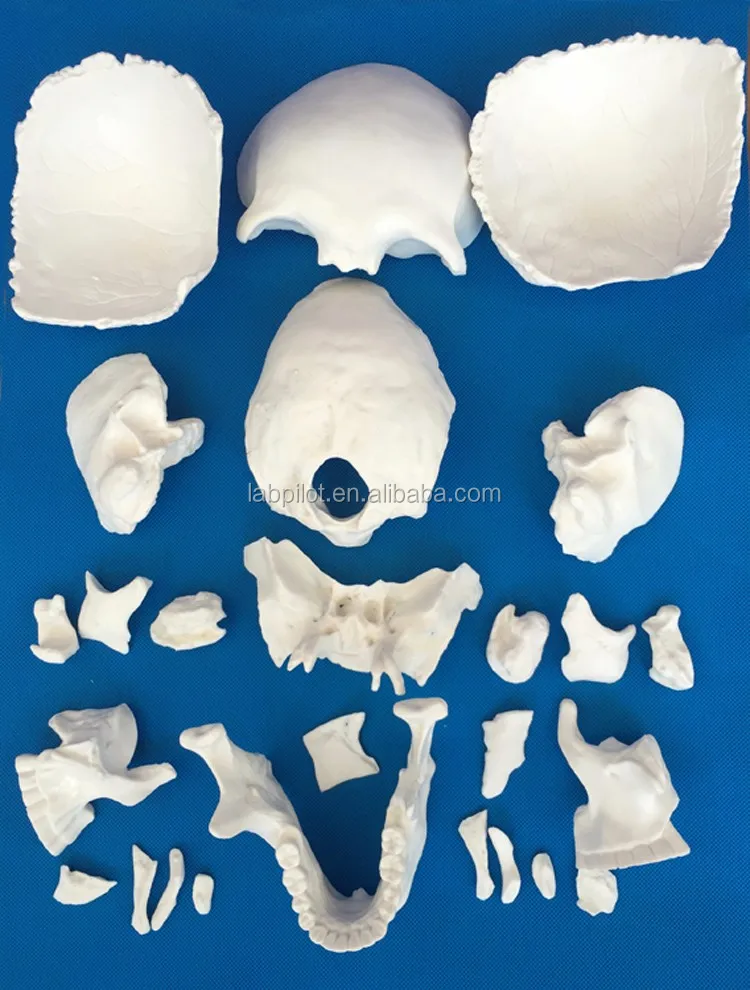 Advanced Scattered Bones Of Skull Model,Skull Dispersive Bone Model ...