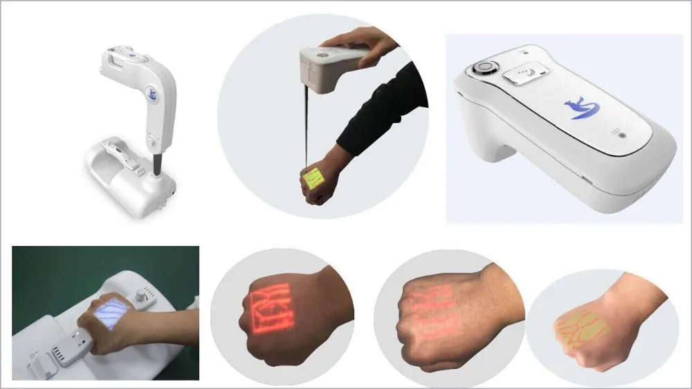 Excellent Infrared Vein Scanner Medical Vein Display Instrument For ...