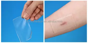 Foryou Medical Scar Removing Band Aid Sheet Skin Silicone Gel Sheet ...