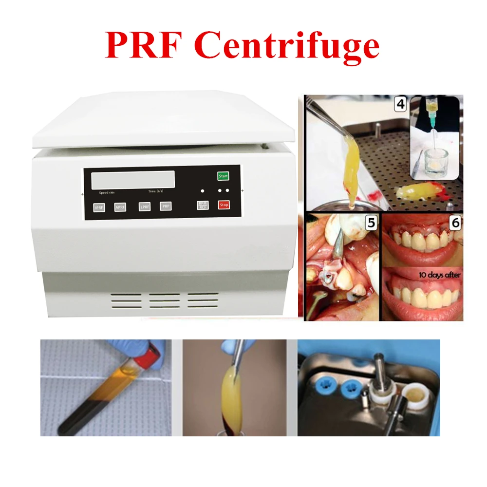 中国制造的牙科prf离心机，包括aprf，iprf，lprf，prp程序 - Buy Dental Prf,Dental Centrifuga ...