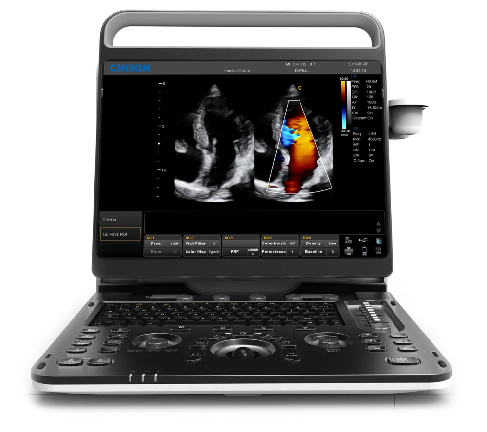 Chison Ebit60 Advanced Cardiac Function Chison Ultrasound With Cw,Tdi ...
