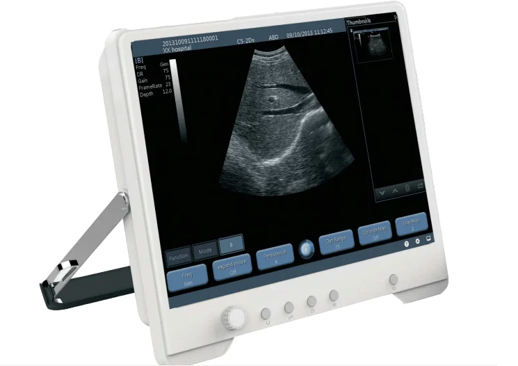 Touch Screen Ipad/tablet Portable Ultrasound/ Multi-functional ...
