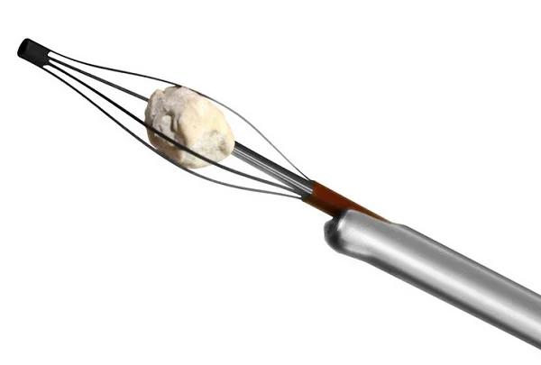 Endoscopic Stone Extraction Basket/urology Stone Extraction Basket ...