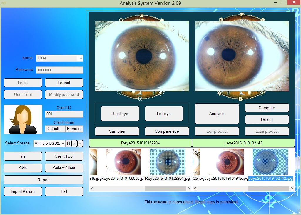 5.0MP USB IRISCOPE - Advanced Iridology Camera for Home Use