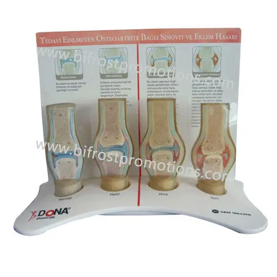 Medical Anatomical Pathological Knee Joint Model - BP72032
