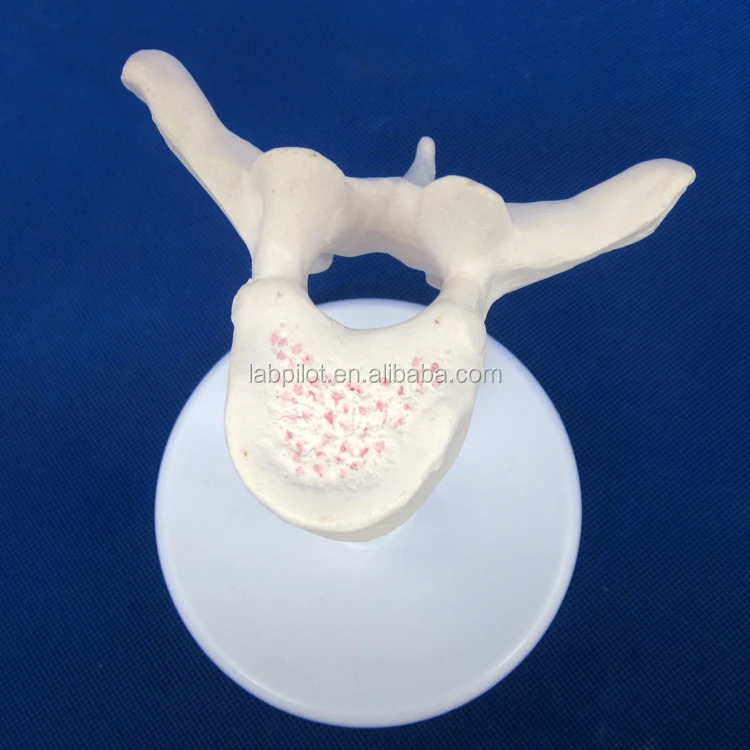 Anatomy Models Of Atlas,Axis,Cervical Vertebra,Thoracic Vertebra And ...