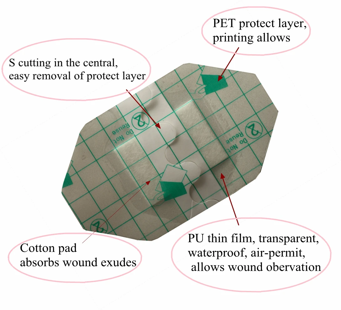Transparent Island Film Dressing - Absorbent Pad Medical Adhesve PU