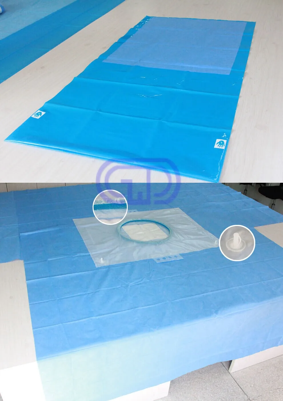 Fenestrated Surgical Drape,Disposable Surgical Set,Surgical Instruments ...