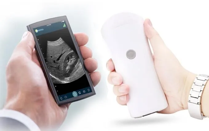 Portable Mini Usg Wifi Smartphone Wireless Ultrasound Probe For Android ...