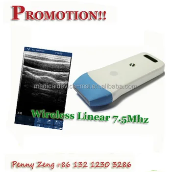 128 Elements Ipad Ultrasound Machine Linear Probe/usg Linear Ultrasound ...