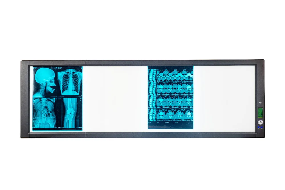 Wall Or Bracket Mounted Led Medical X-ray Illuminator / Ultra High ...