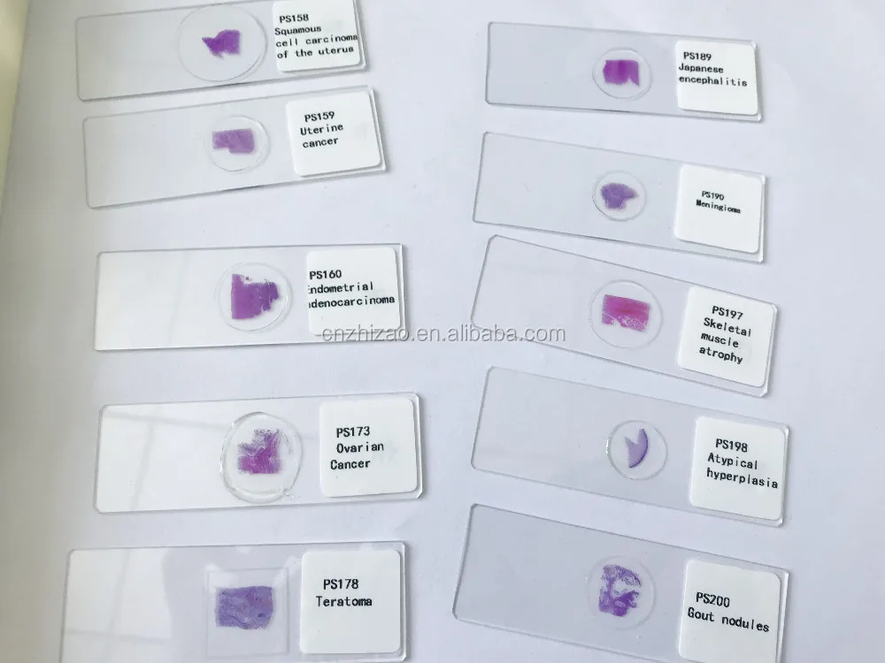 Professional 200 Pieces Set Microscope Human Pathology Prepared Slides ...