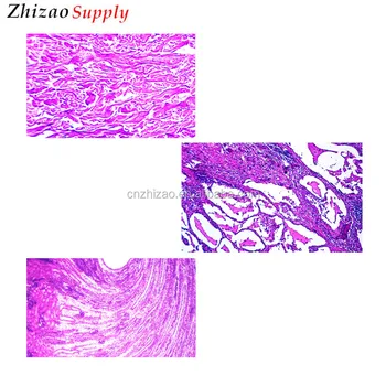200pcs Human Pathology Slides Set,Pathological Prepared Slides ...