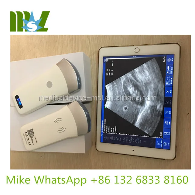 Mini Ultrasound Machine & Wireless Portable Ultrasound Mslpu31 - Buy ...