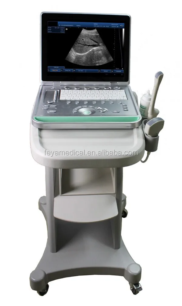 Fy-ss-9 3d Portable Ultrasound Scan Machine Price - Buy 3d Ultrasound ...