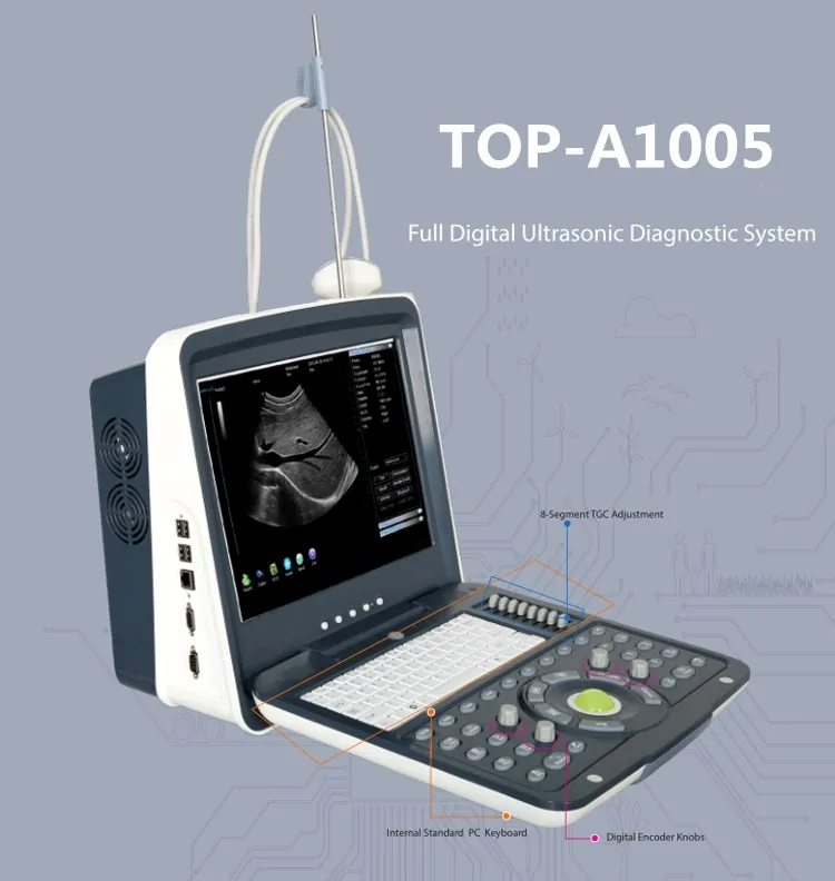 Laptop Full Digital Ultrasound Scanner,3d 4d Portable Laptop Ultrasound ...