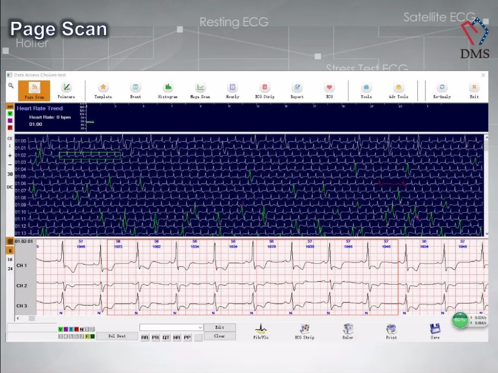 Dms Ecg Holter Recorder For Heart Electrocardiogram 12 Lead 10 ...