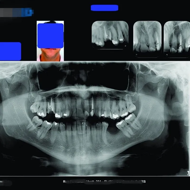 Fuji Drypix 3500 Medical Blue Sensitive X-ray Film 14x17inch - Buy Blue ...