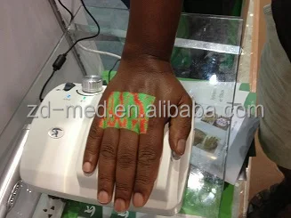 Vein Transillumination Medical Device - Buy Injectionhandheld Vein ...