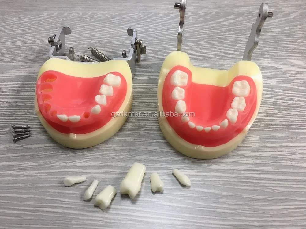 Pediatric Dentition Dental Model - 24PCS Replacement Teeth