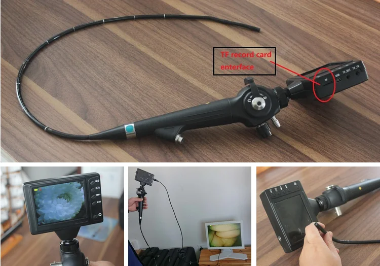 Flexible Cystoscope,Flexible Nasal Ent Endoscope Full Hd Ent Endoscope ...