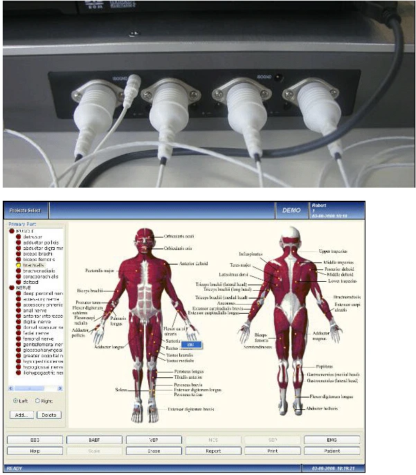 Professional Emg Ep Systems Electromyography Myoelectricity Measuring ...