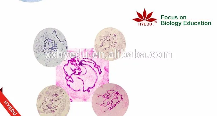 Fixed Set High Quality 14 Pieces Chromosome Microscope Prepared Slides ...