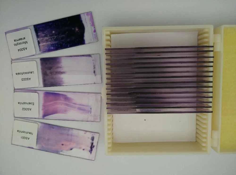 18pcs Hematology Prepared Slides Blood Smear Prepared Slides - Buy ...