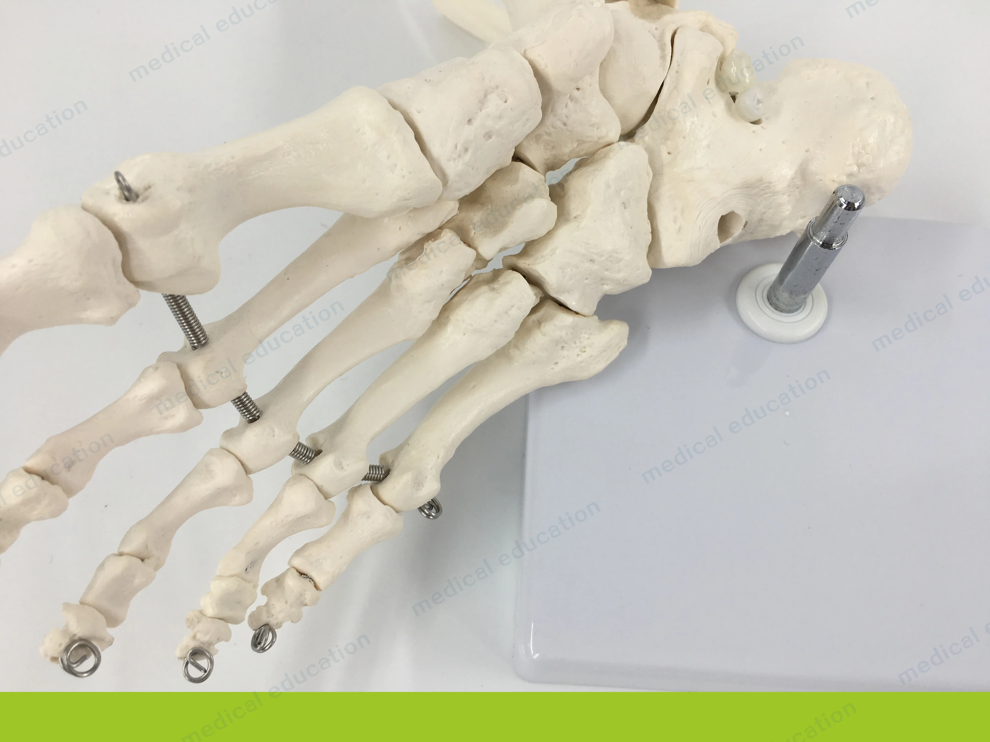 Skeletal Model Simulation Of Orthopaedic Specimens Of Foot,Ankle And ...