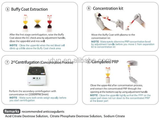Platelet Rich Plasma Prp Centrifuge For Buffy Coat 20cc 30cc Prp Tubes ...