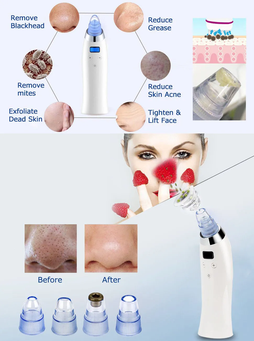 Pores Cleaner Comedo Vacuum Suction Beauty Machine - Buy Pores Cleaner ...
