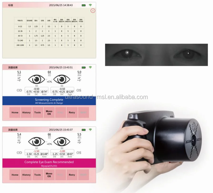 Ophthalmology Equipment Vision Screener,Ocular Screening Tester - Buy ...