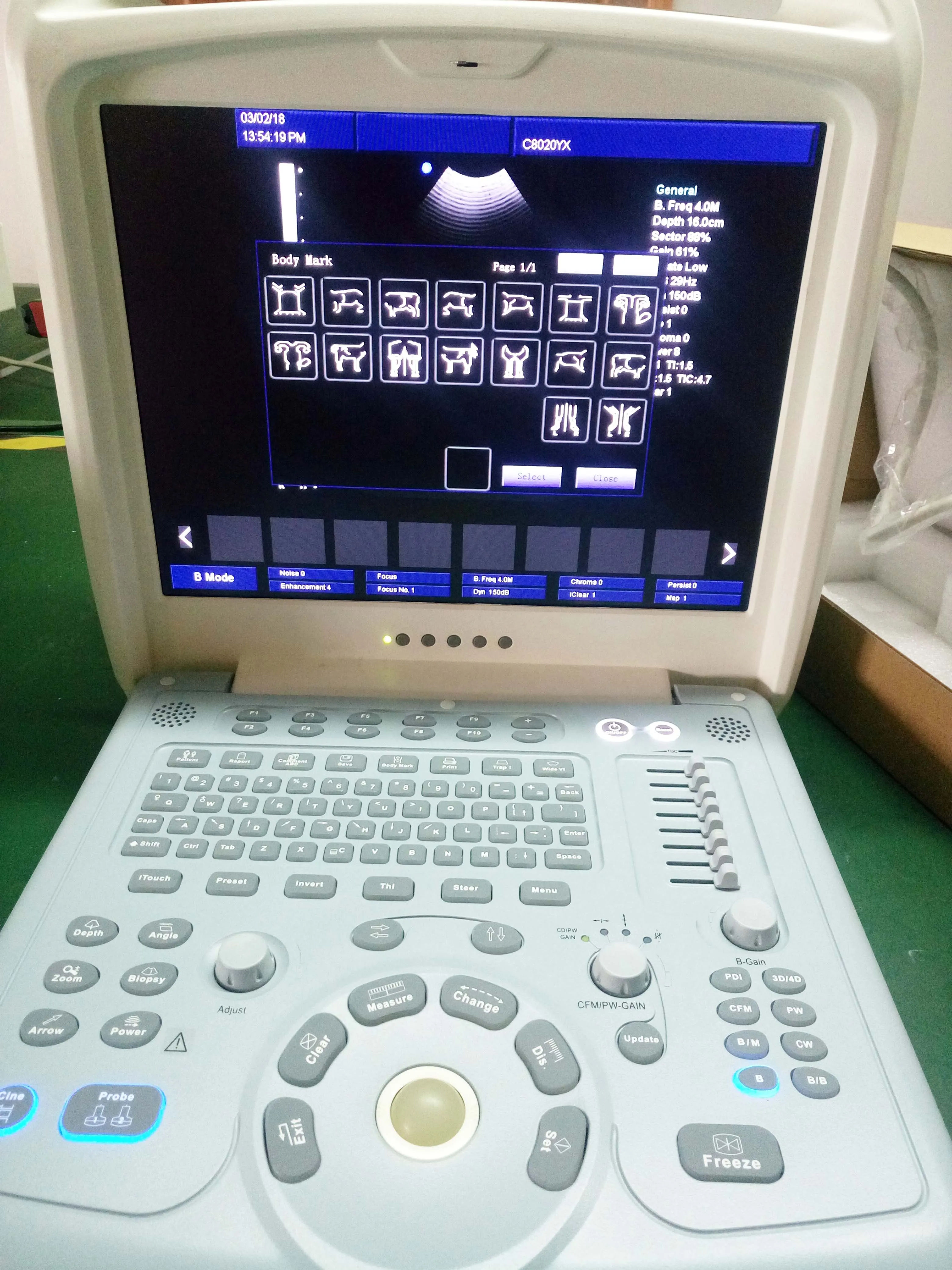 Portable Echography Fetal Doppler 2d/3d Ultrasound Diagnostic ...
