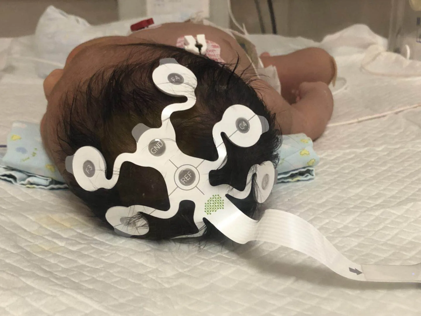 Greentek Disposable EEG Electrode Array for NICU Monitoring
