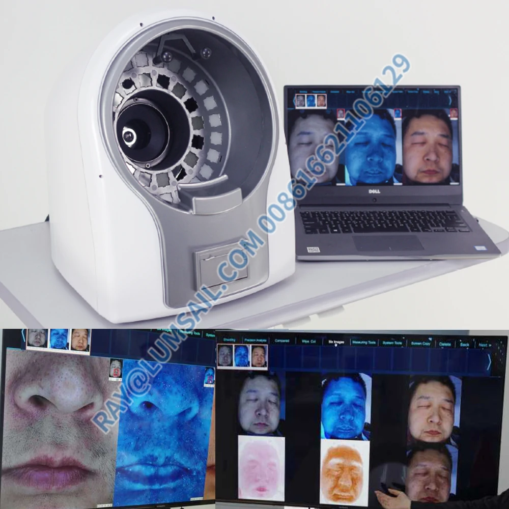 Intelligent Digital Face Smart Skin Analyzer Made In China - Buy Smart ...