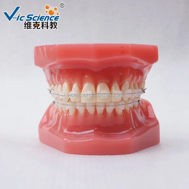 All Ortho Ceramic Bracket Teeth Model Dental Simulation Model Practice ...